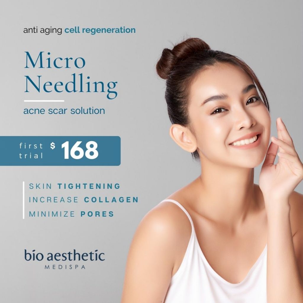Microneedling - Price & Review (2025) Singapore - Bio Aesthetic