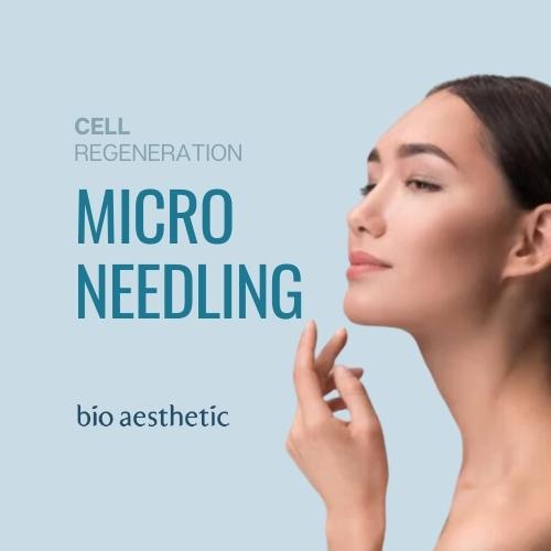 Microneedling - Price & Review (2025) Singapore - Bio Aesthetic