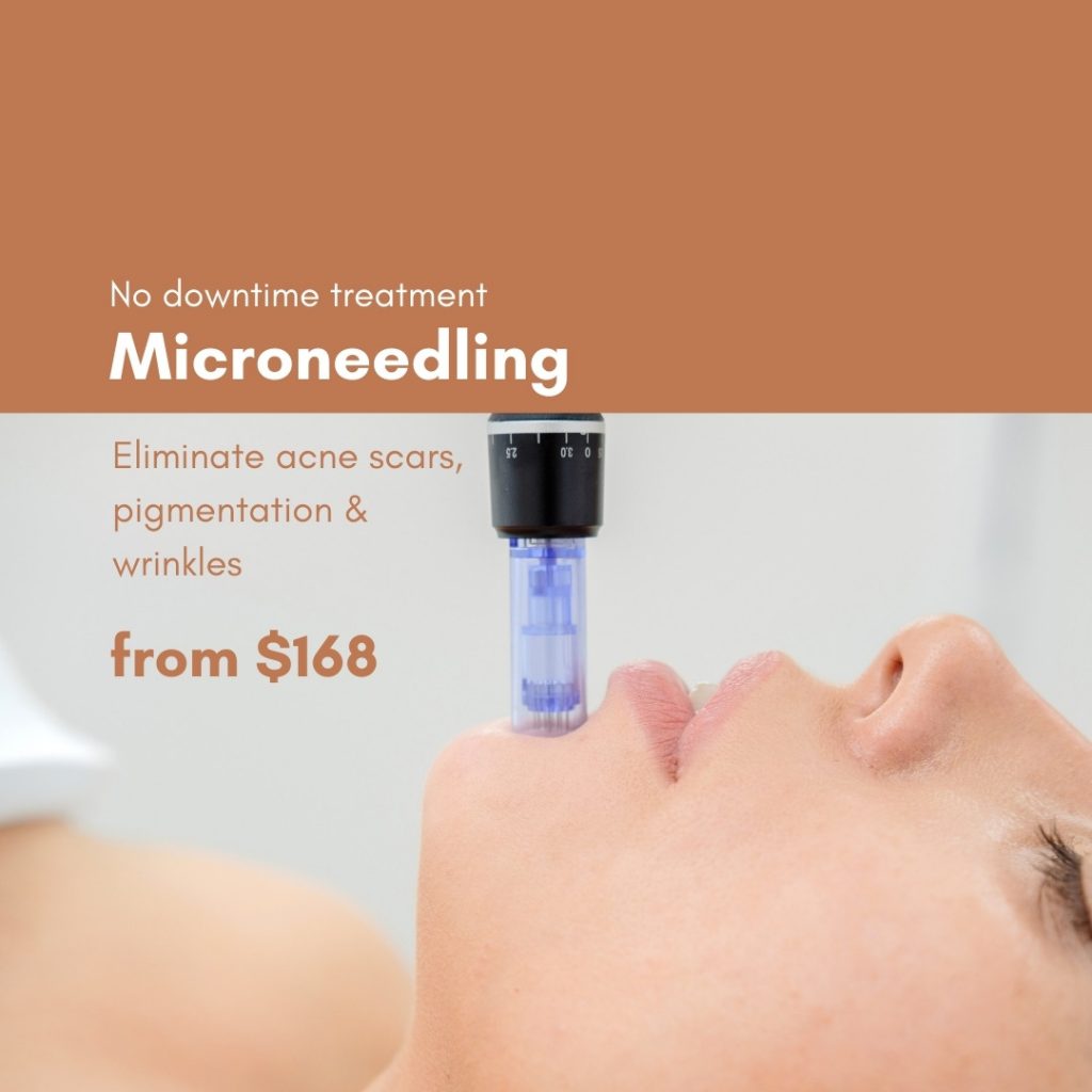 Microneedling in Singapore - Minimize Pore & Acne Scar - Bio Aesthetic