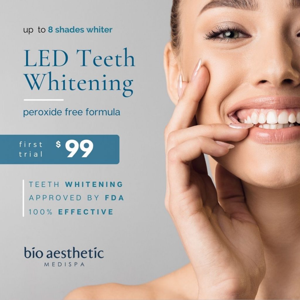 Teeth Whitening Singapore - Price Guide (2024) - Bio Aesthetic