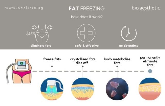 Fat Freezing Complete Cost & Price Guide (2026) - Bio Aesthetic