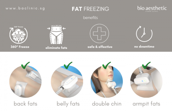 Fat Freezing Before and After (2024) - Benefits - Bio Aesthetic