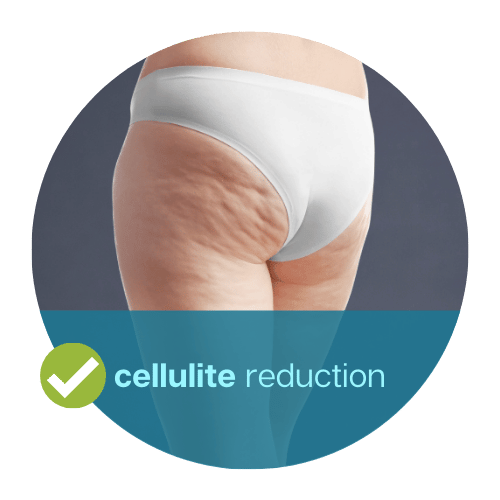 Venus Legacy: Cellulite Reduction & Skin Tightening - 2025 Price