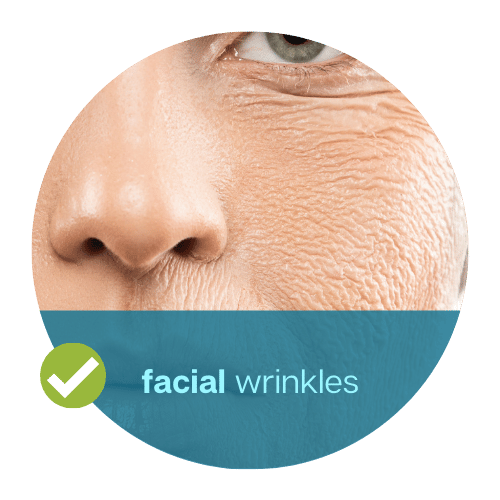 Microneedling - Price & Review (2025) Singapore - Bio Aesthetic