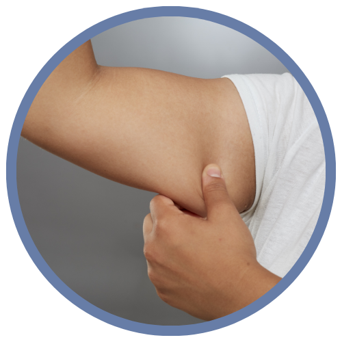 Fat Freezing Trial - $99 Trial | Up to 25% Fat Reduction