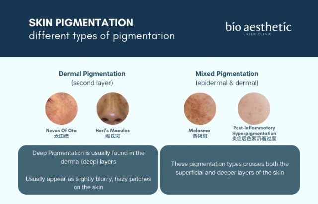 Understanding Skin Pigmentation and How to Reduce It - Bio Aesthetic