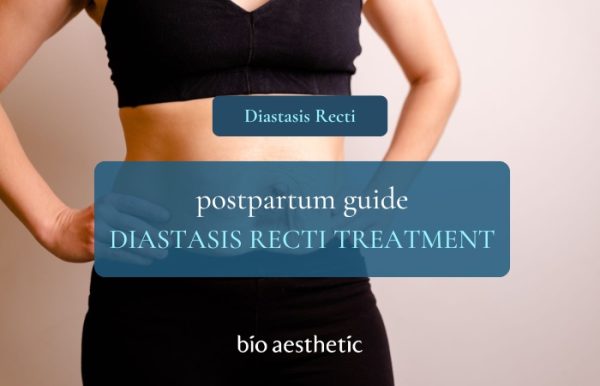 Comprehensive Guide to Diastasis Recti Treatment Options