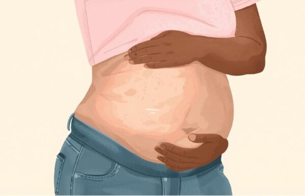 Postpartum Belly: What’s Normal vs Treatable After Pregnancy (SG Guide)